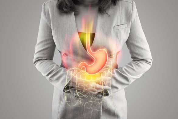 Appendix: What Food Can Cause Appendicitis? - Healthwire