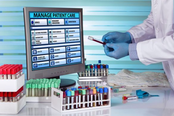 Types of Heart Tests - An A-Z Guide for You! - Healthwire