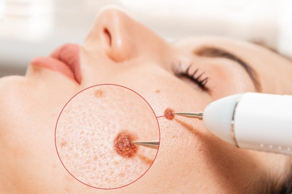 Naswar Side Effects: Get to Know About This Addiction - Healthwire