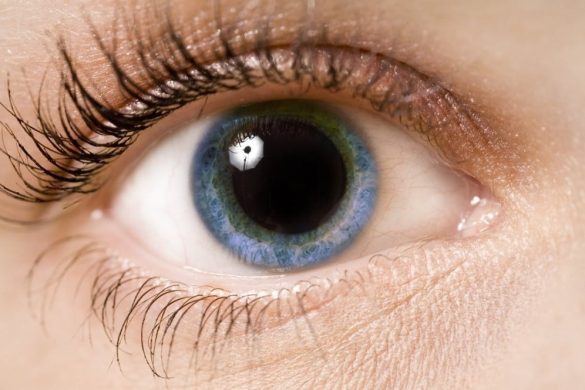 How to Get Rid of Yellow Eyes? Home Remedies That Work - Healthwire