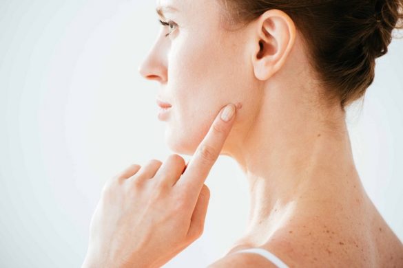 5 Best Sunscreen in Pakistan for all Skin Types - Healthwire