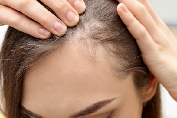 Everything You Need to Know About Birth Control Pills in Pakistan ...